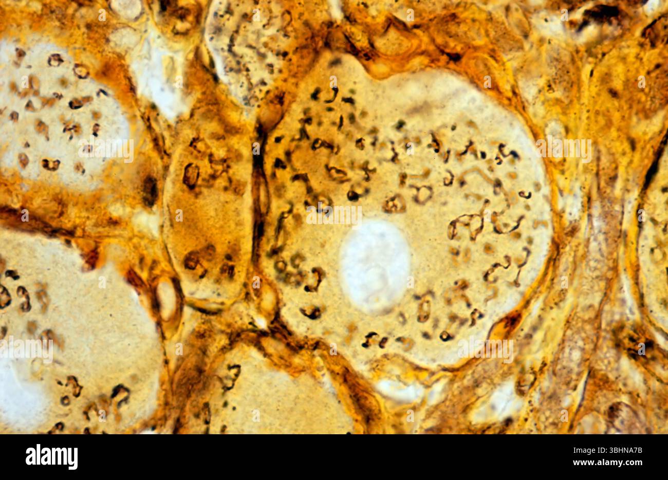 Light micrograph showing Golgi apparatus in neurons (nerve cells) of a ...