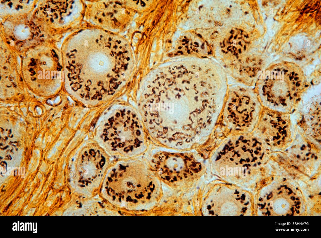 Light micrograph showing Golgi apparatus in neurons (nerve cells) of a ...