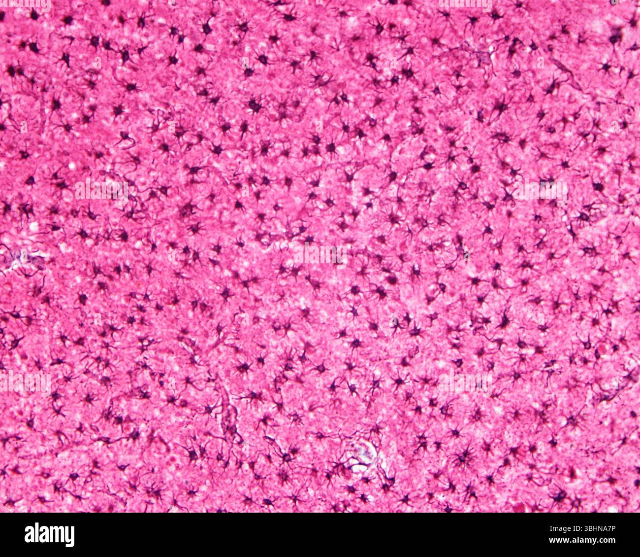 Light micrograph showing protoplasmic astrocytes in the cerebral cortex ...