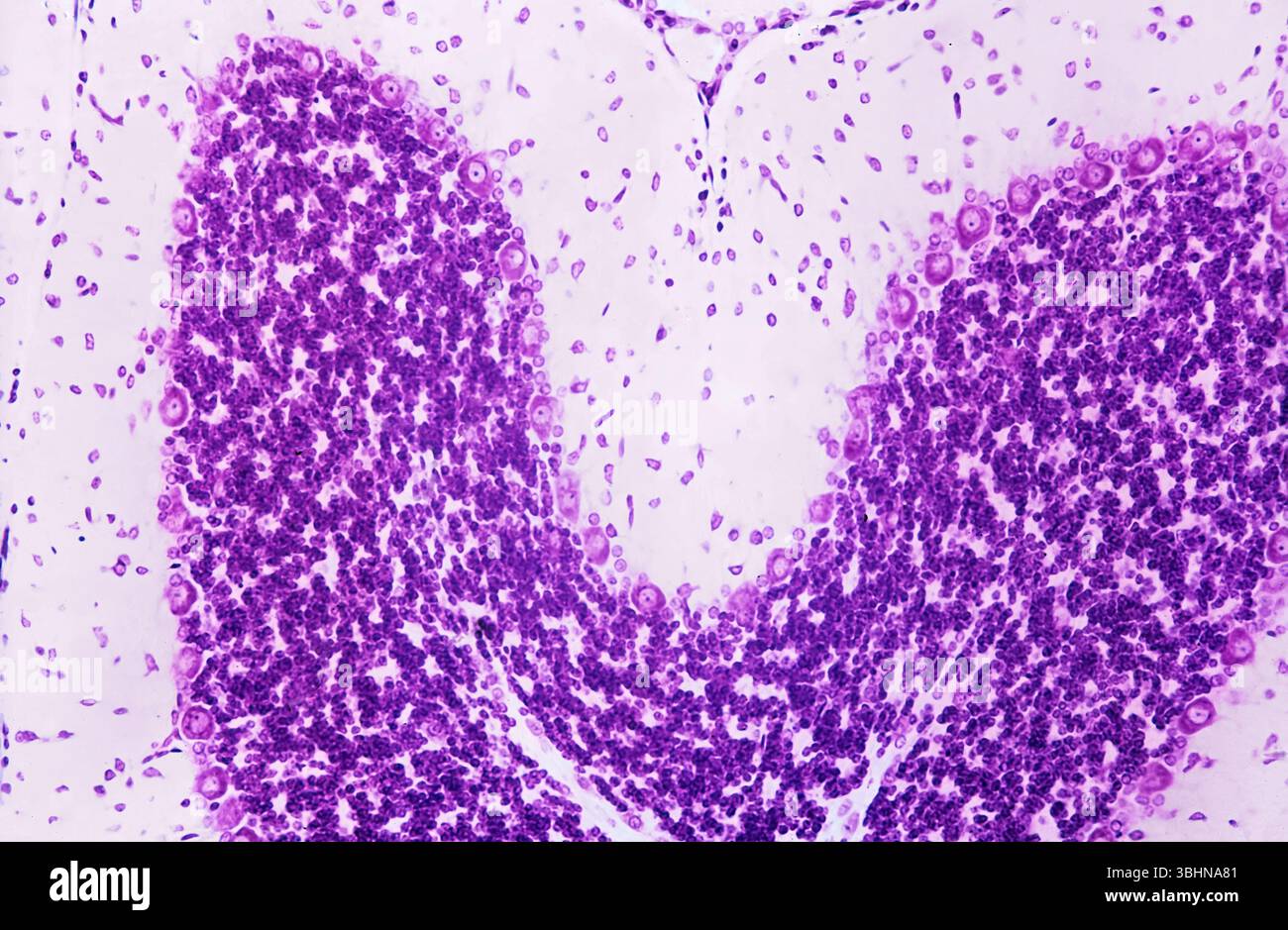 Light micrograph showing the layers of the cerebellar cortex. From top ...