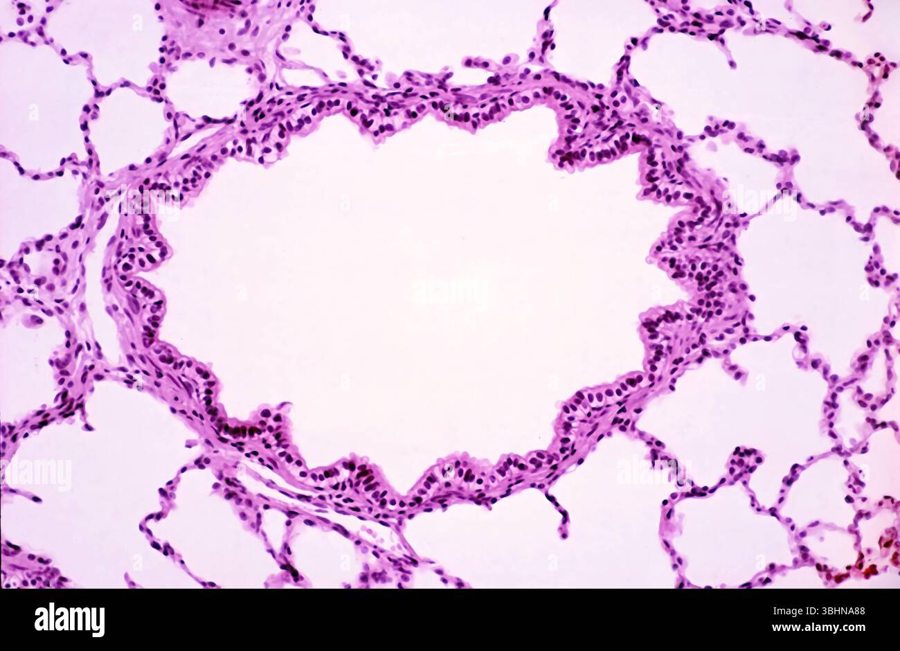 Light micrograph of a cross-sectioned terminal bronchiole. It is lined ...