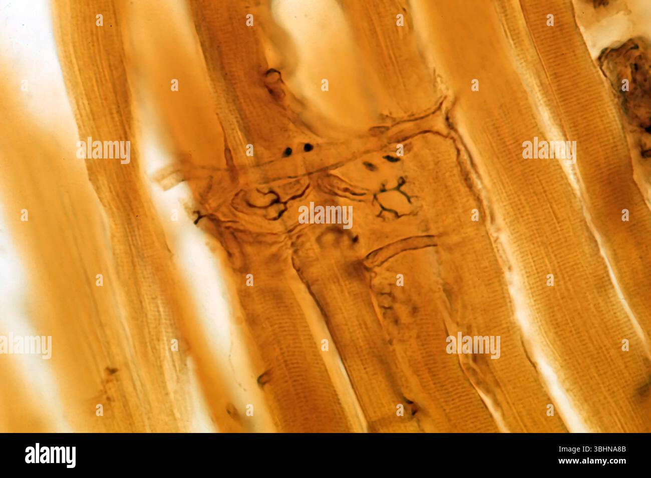 Light micrograph showing motor neuron axons making motor end plates ...