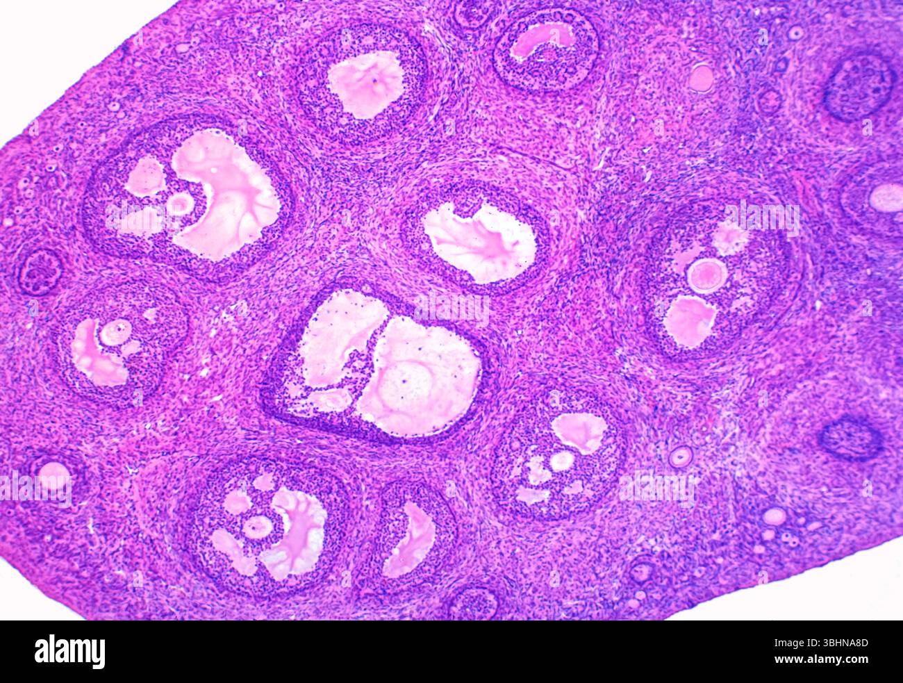 Light micrograph of a rabbit ovary showing ovarian follicles ...