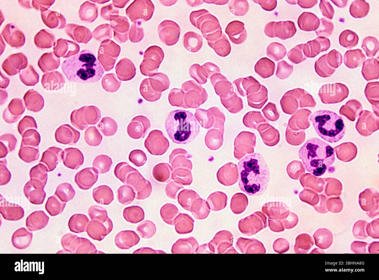 Light micrograph of a human blood smear showing five neutrophil ...
