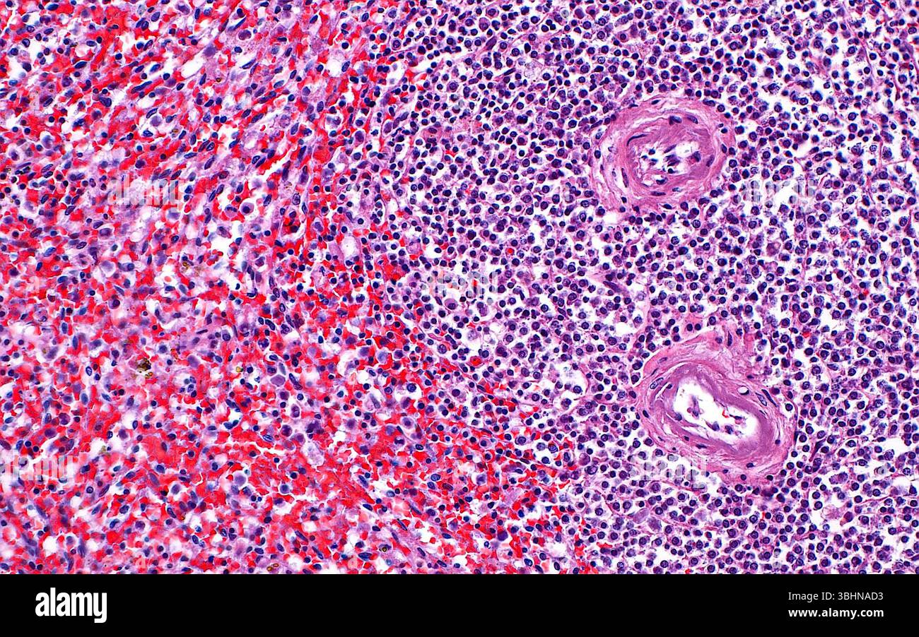 Light micrograph of spleen. The spleen consists of red pulp containing ...