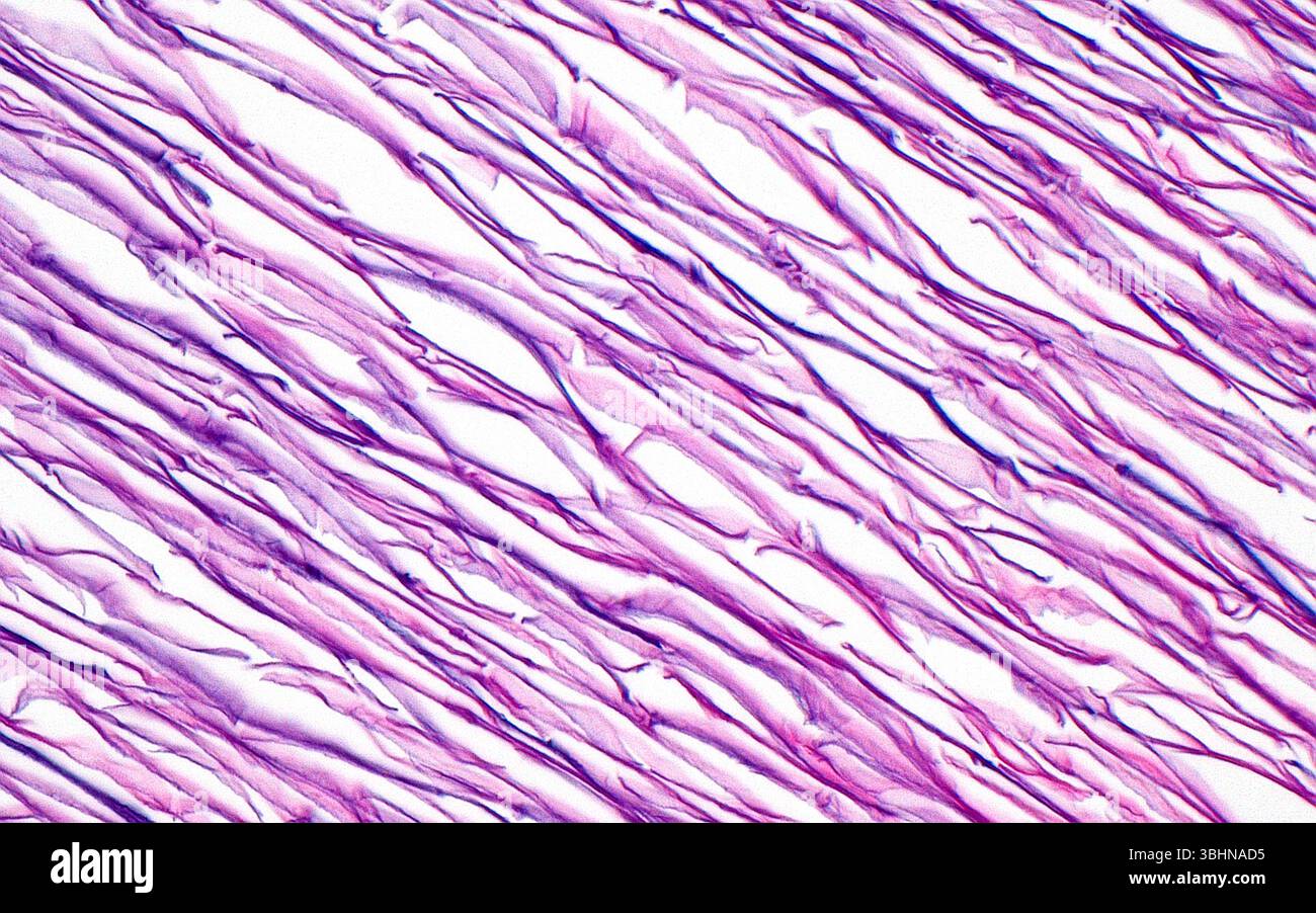 Light micrograph of keratin substance. Keratin is a substance produced ...