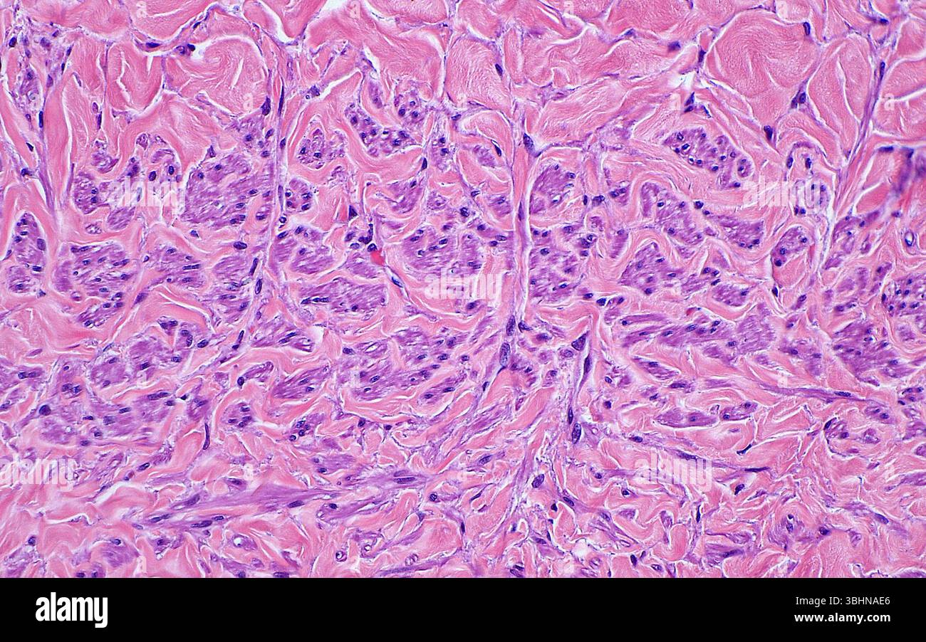 Light micrograph of media of a wall of a vein. The wall of large veins ...