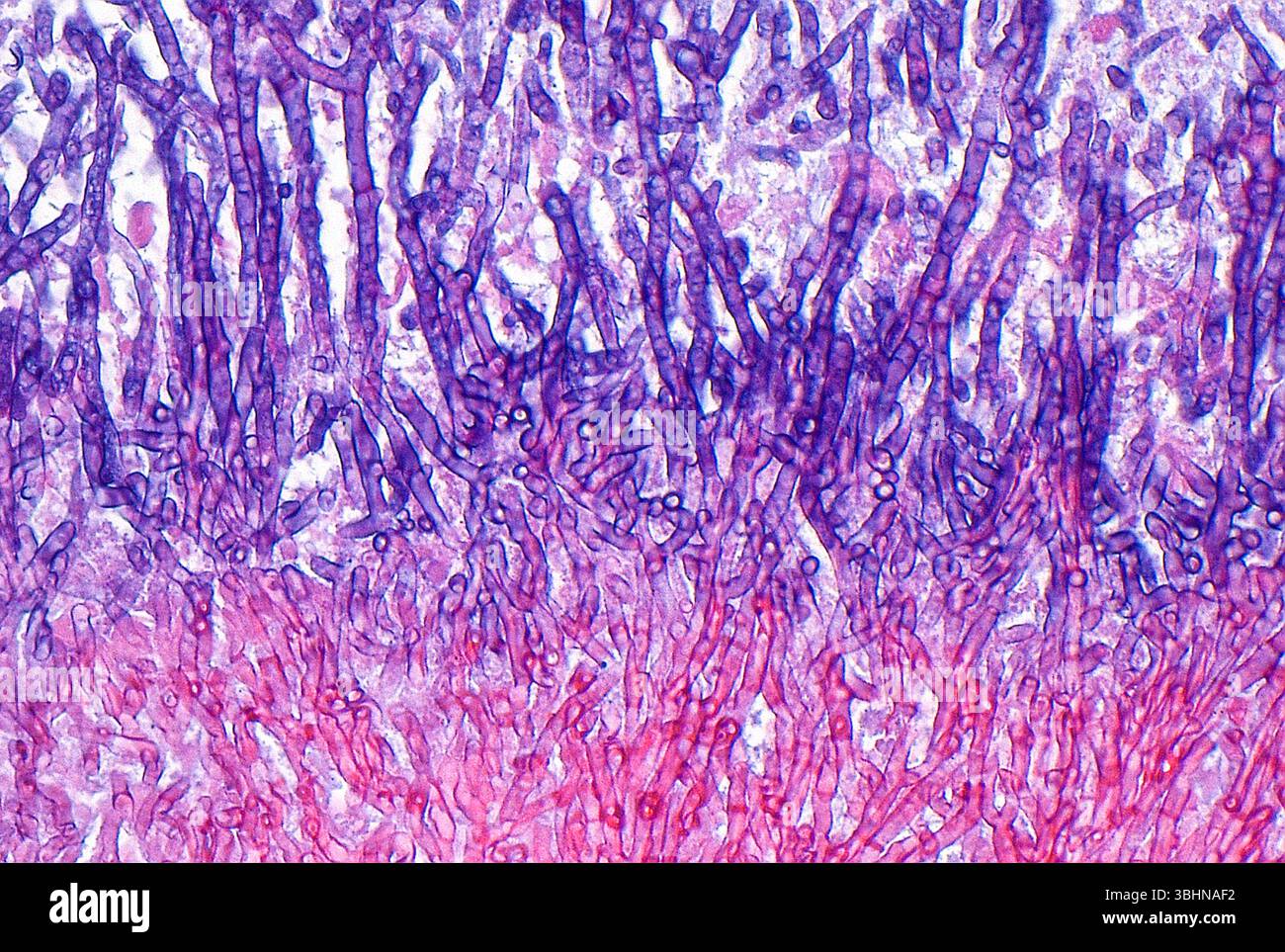 Light micrograph of fungal organisms. Fungus showing hyphae (elongated and branching structures ...