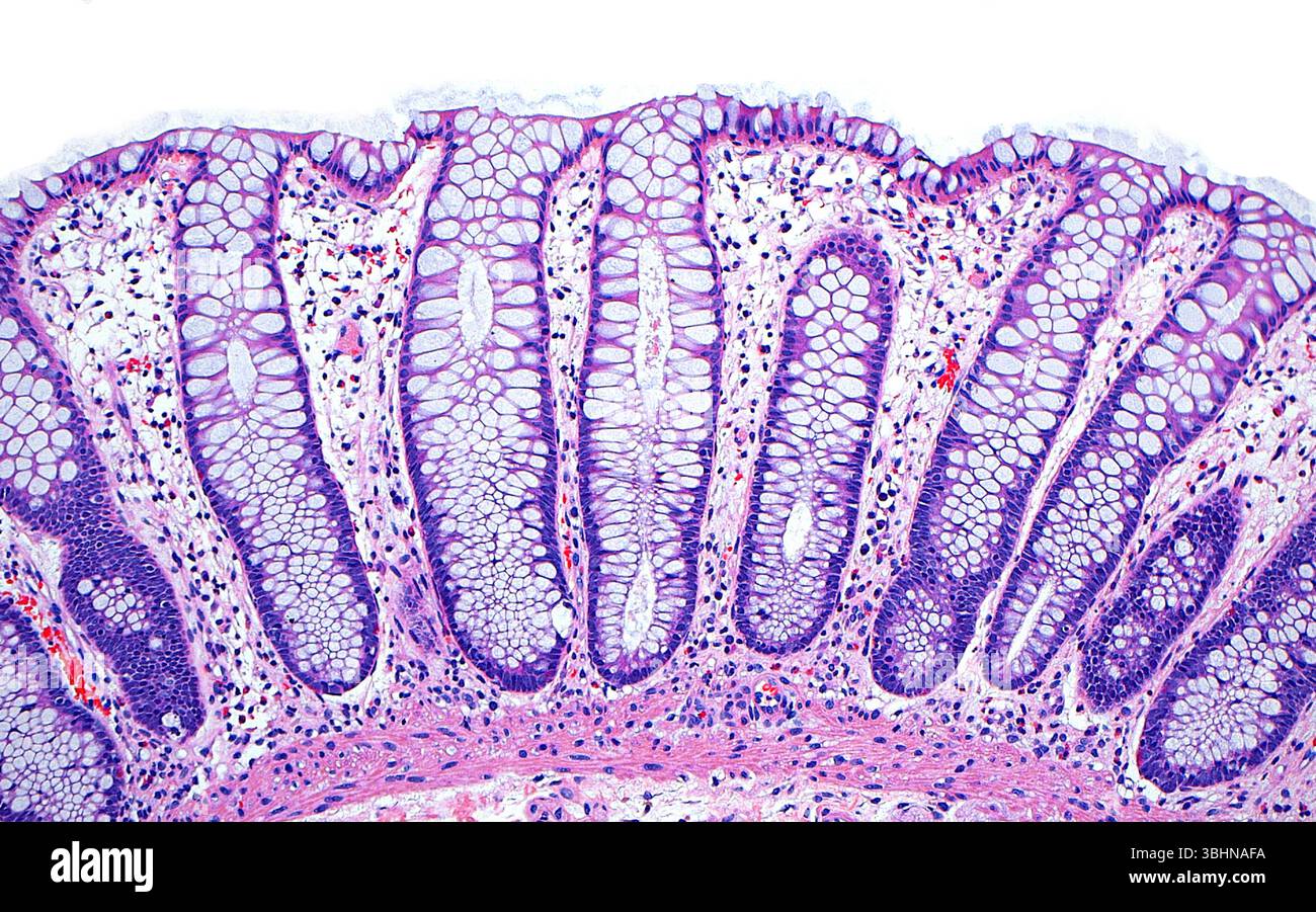 Light micrograph of colon epithelial crypts. The lining surface of the ...