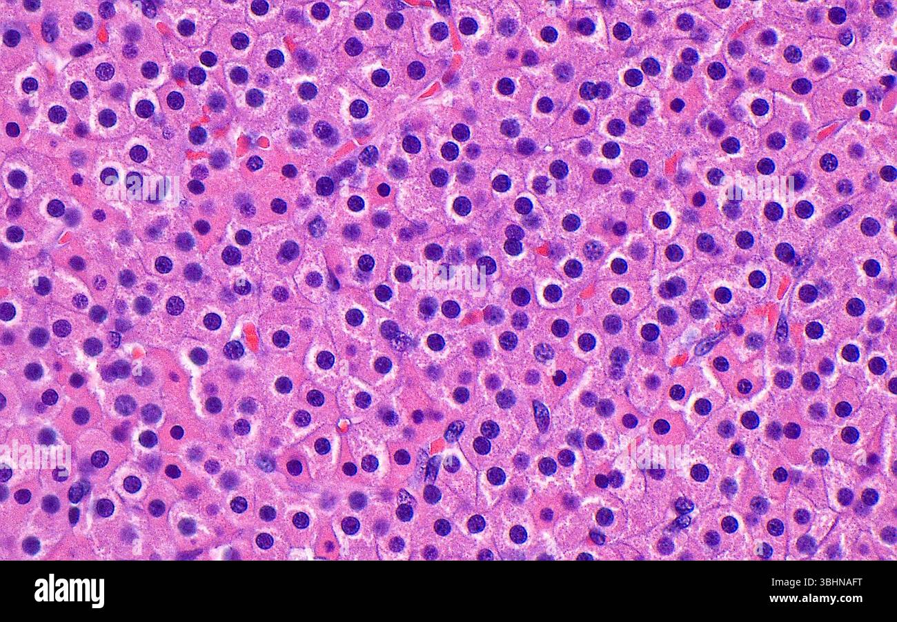 Light micrograph of parathyroid oxyphil cells. Oxyphil cells are one of ...