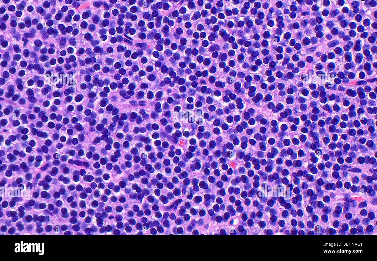 Light micrograph of parathyroid chief cells. Chief cells are one of the ...