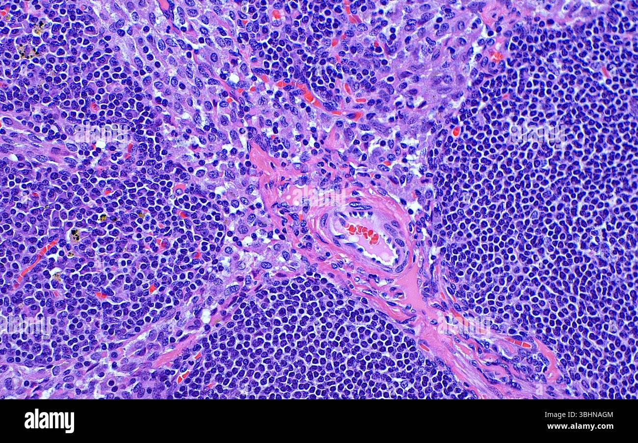 Light micrograph of lymph node. A lymph node includes lymphocytic cells ...