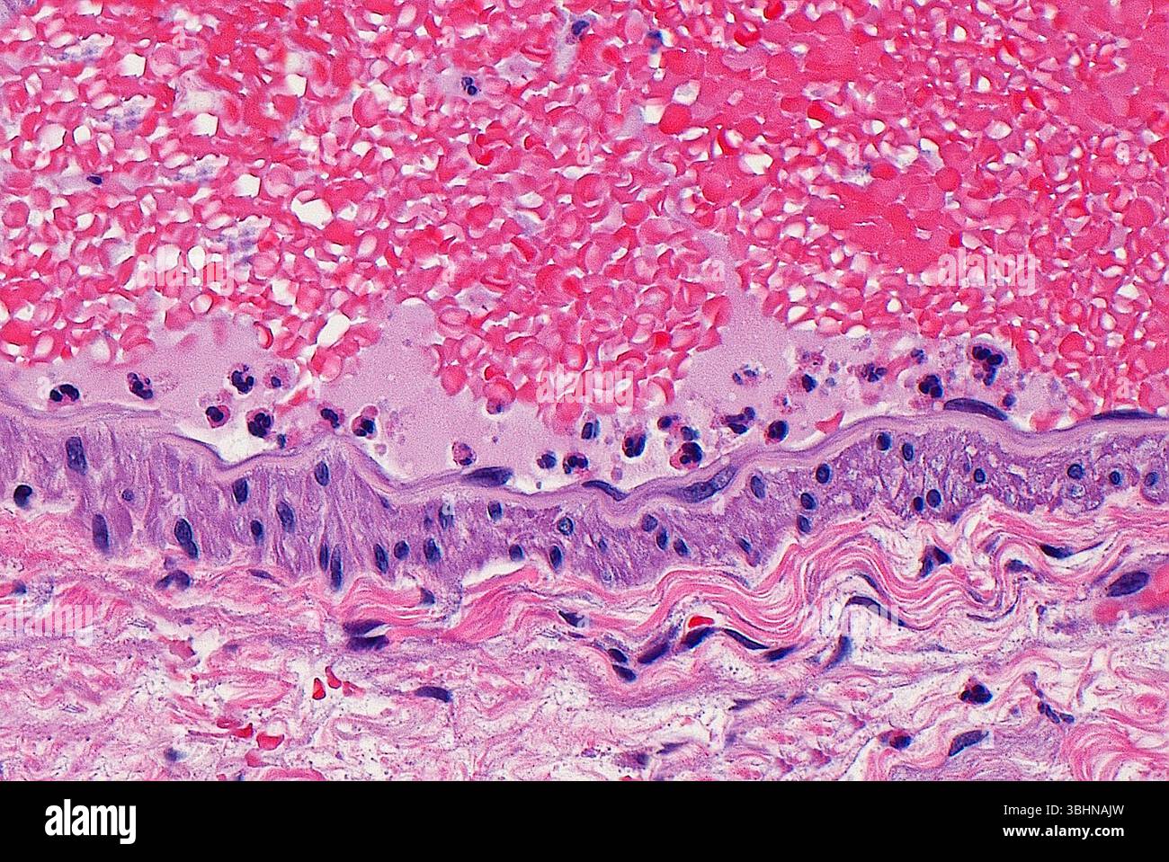Neutrophil margination, light micrograph Stock Photo - Alamy