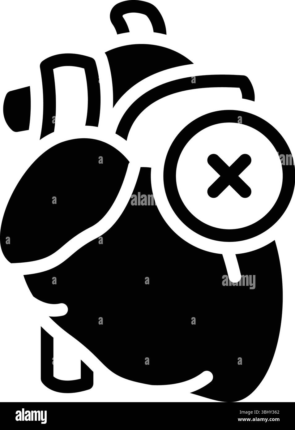 Congestive heart failure Stock Vector Images - Alamy