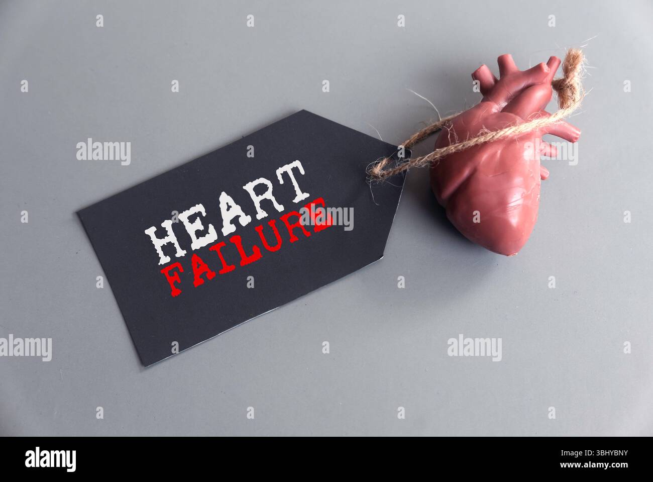 Heart Failure Concept with Anatomical Heart Model and Tag Stock Photo ...