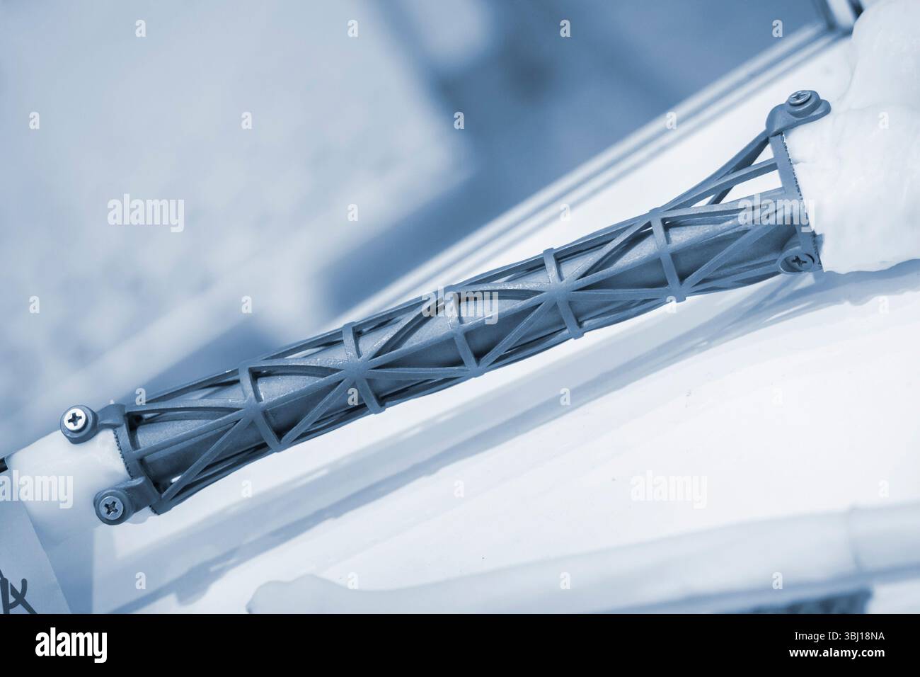 Endoexprosthesis hi-res stock photography and images - Alamy