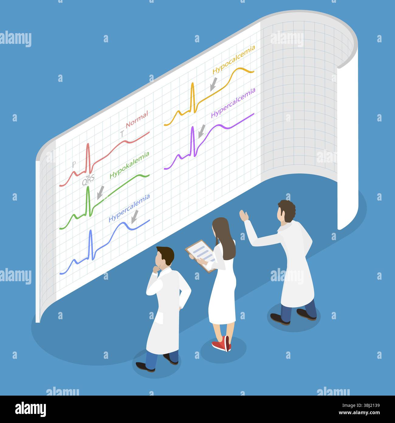 3D Isometric Flat Illustration of ECG Changes, Cardiac Rhythms Stock ...