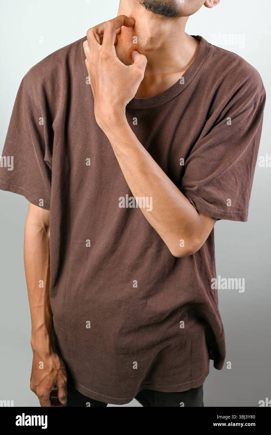 Portrait of a man scratching his neck skin isolated over a white ...