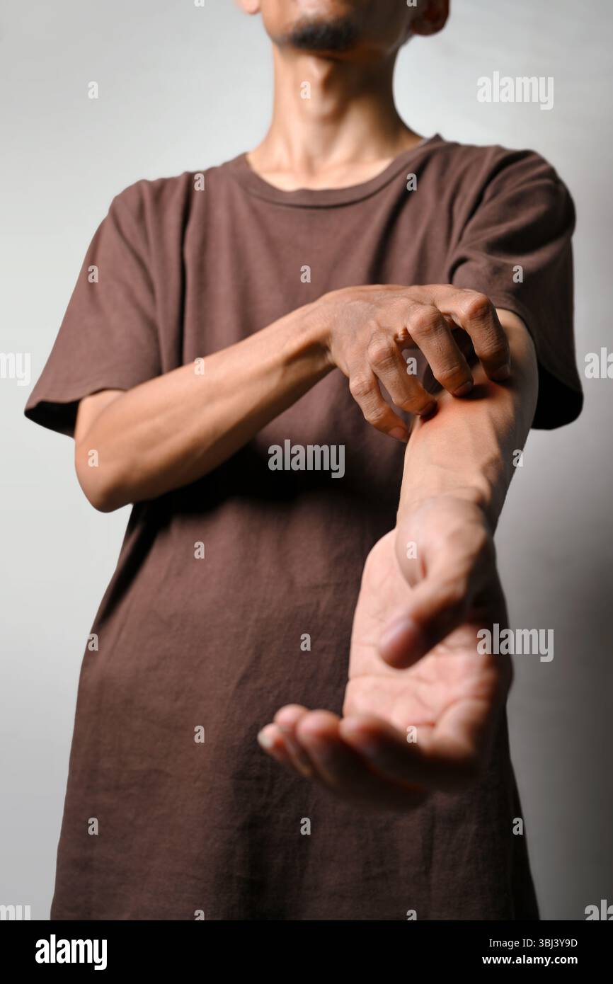 Portrait of a man scratching his arm skin isolated over a white ...