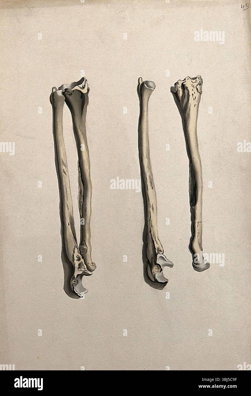 Radius and ulna bones: two figures, 1830-1835 Stock Photo - Alamy