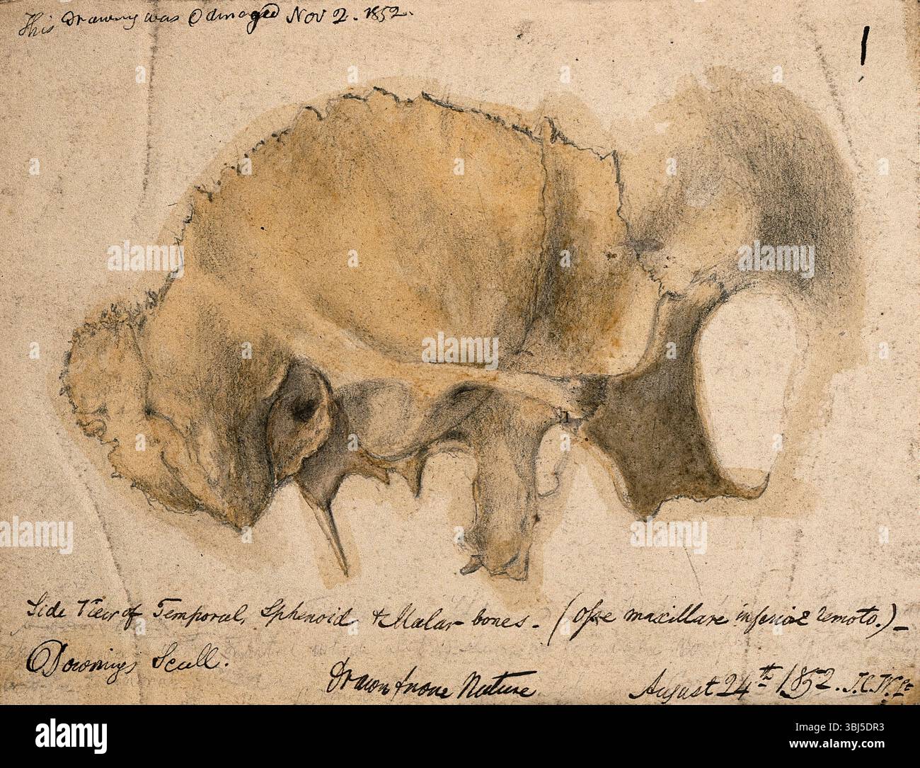 Bones of the cheek: side view of the temporal, schenoid and malar bones ...