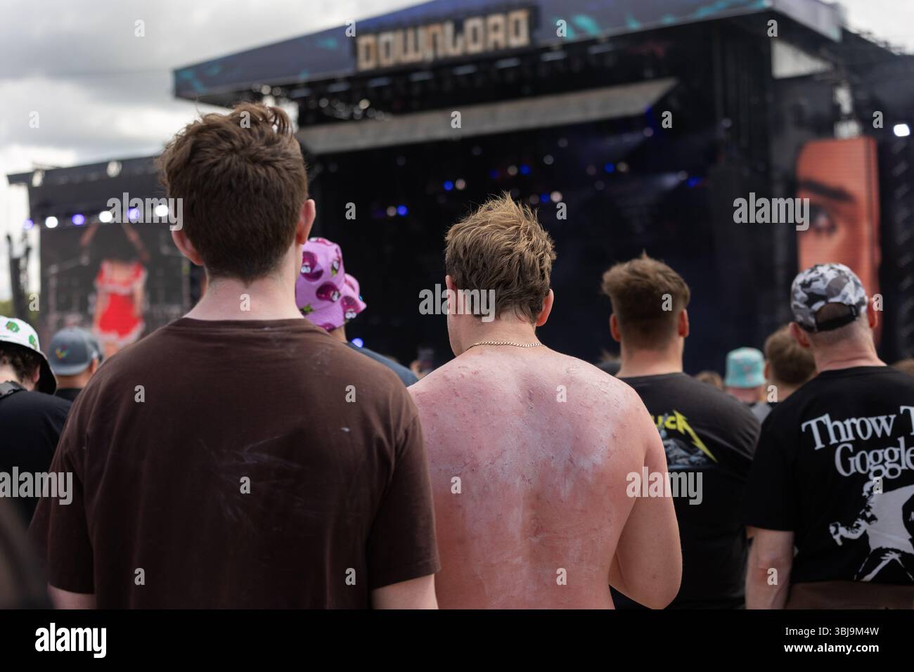 Leicestershire, UK. Saturday June 14, 2025. A man pictured with sunburn ...