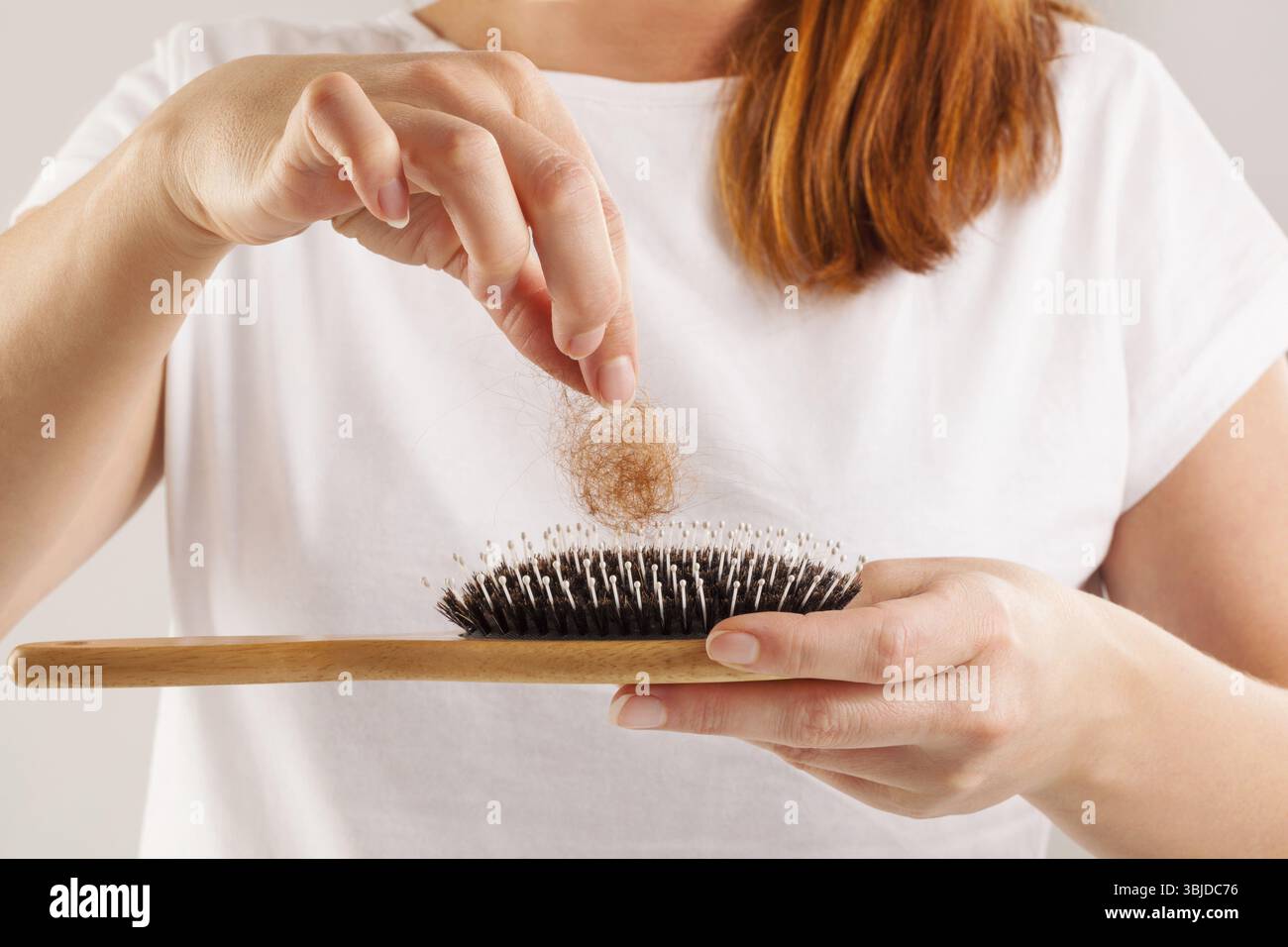 Women's Hair Loss. Beautiful redhair with hair tuft in hair isolated ...