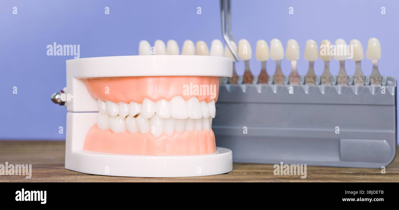 Artificial dental jaw model displayed alongside a tooth color shade ...