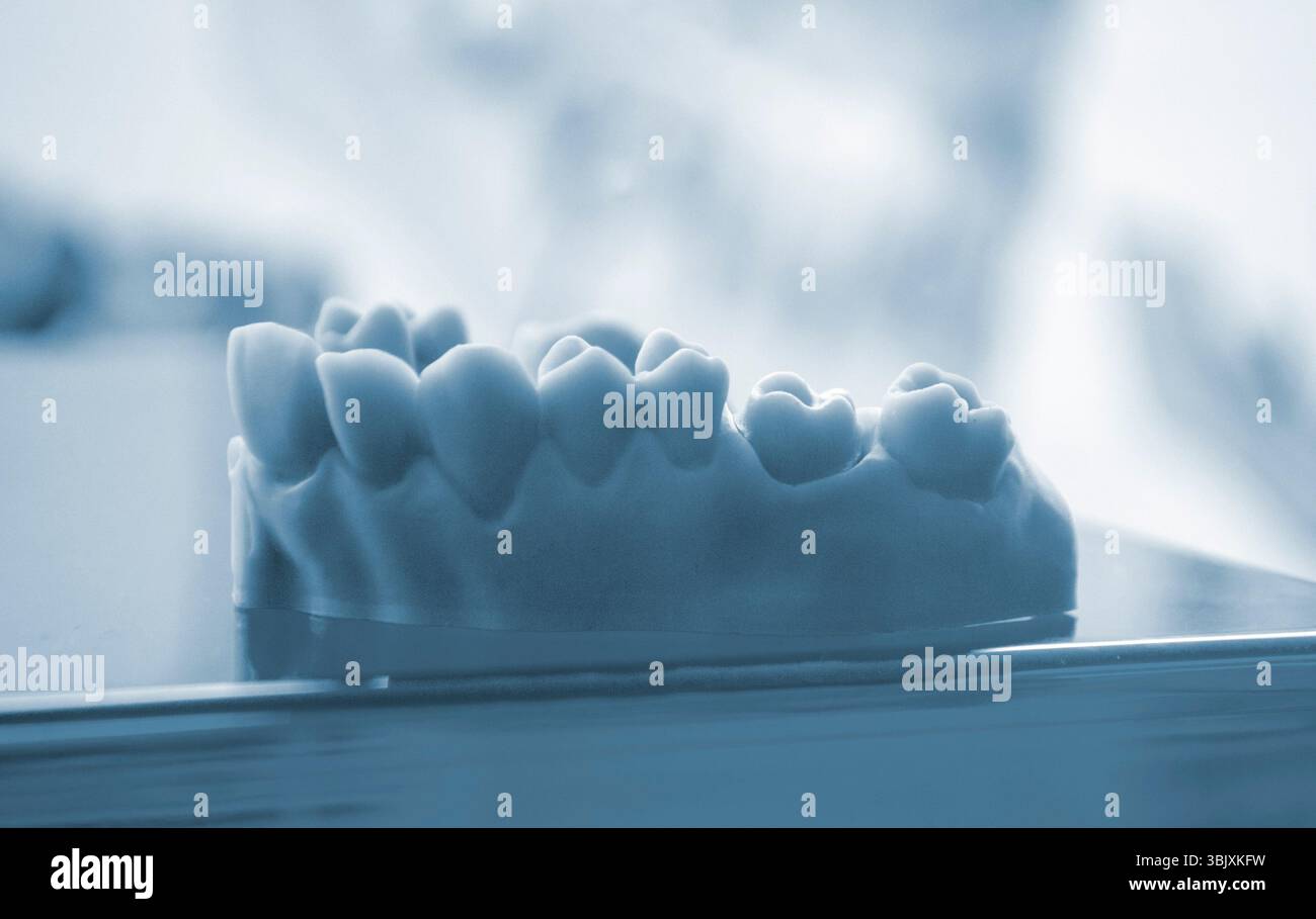 Prototype of human jaw gums and teeth printed on 3D printer from ...