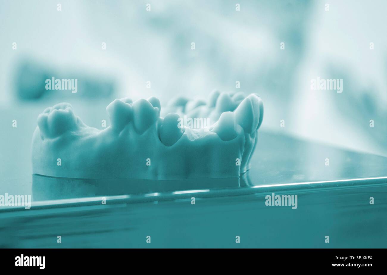 Prototype of human jaw gums and teeth printed on 3D printer from ...