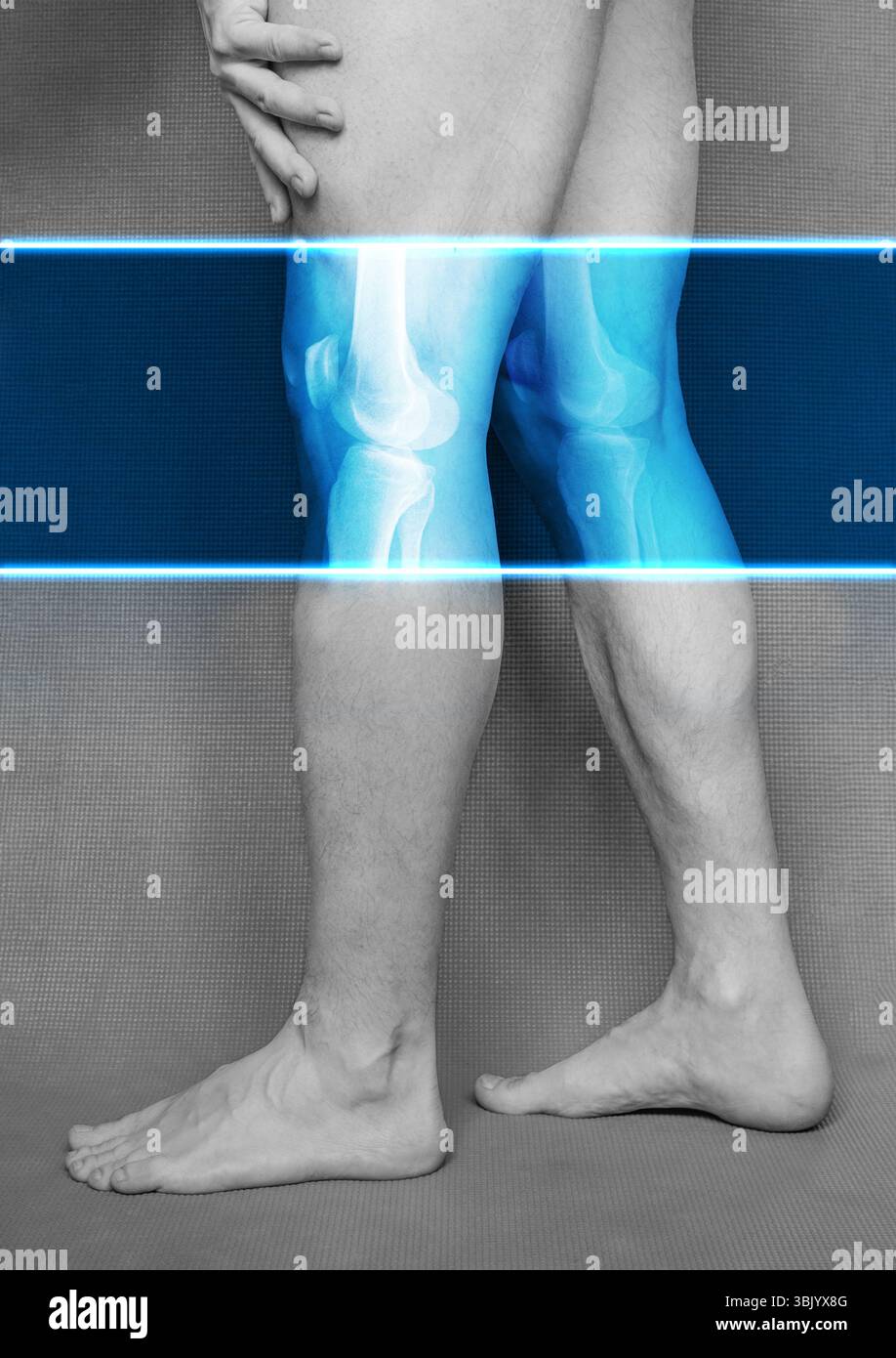 Composite image showing a man's knees under X-ray — blending visible ...