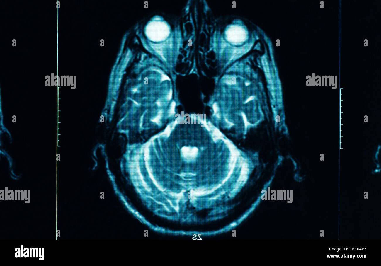 sharp ct scan of the human brain Stock Photo - Alamy