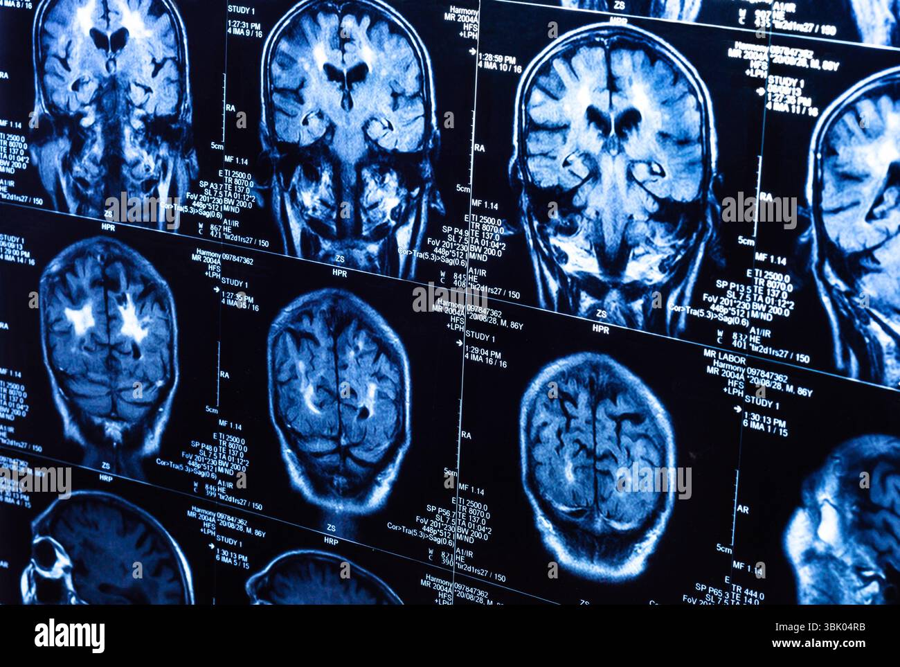 A group of CAT scans of the human brain closeup Stock Photo - Alamy