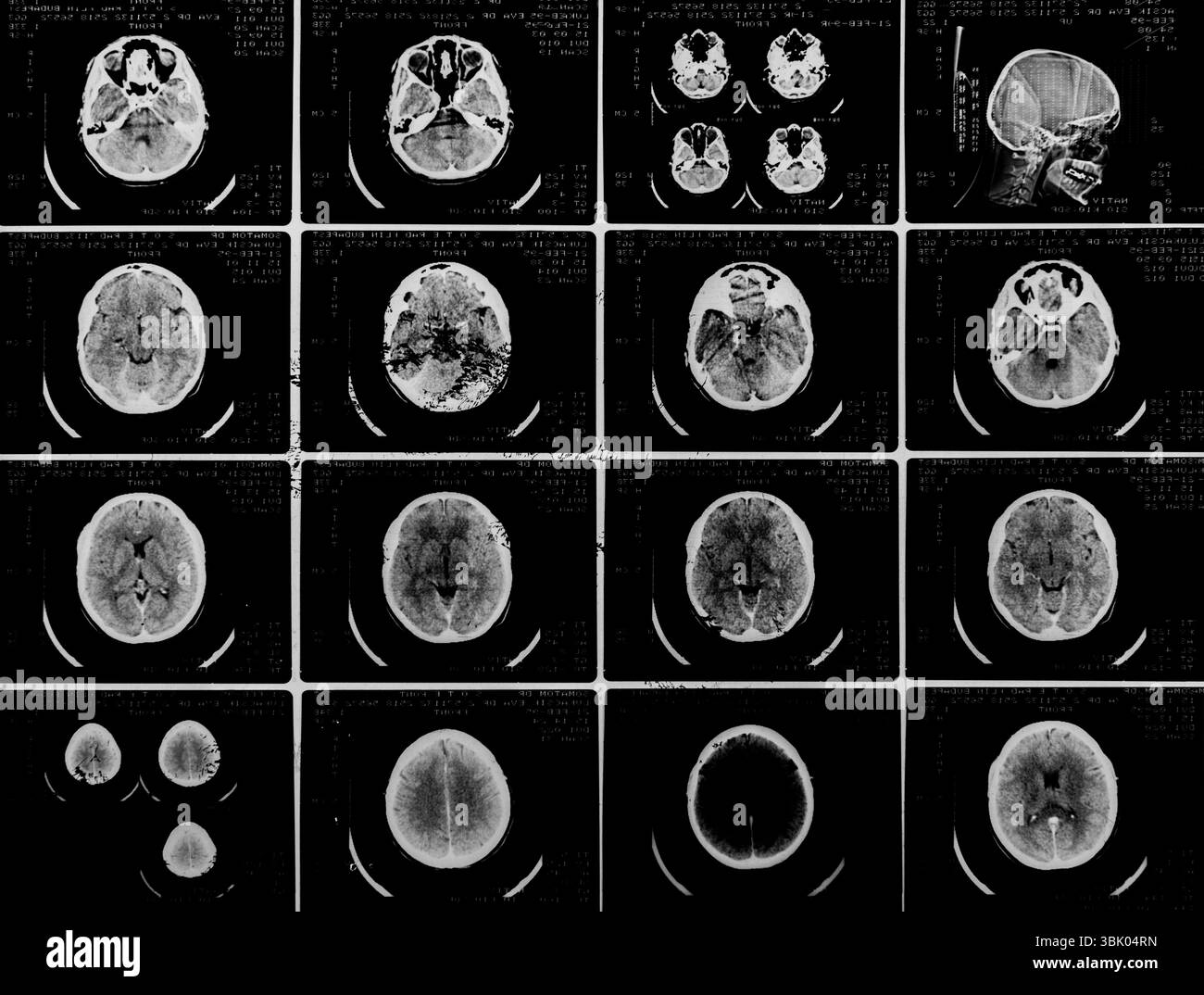 Glowing and radiant MRI scan closeup photo Stock Photo - Alamy