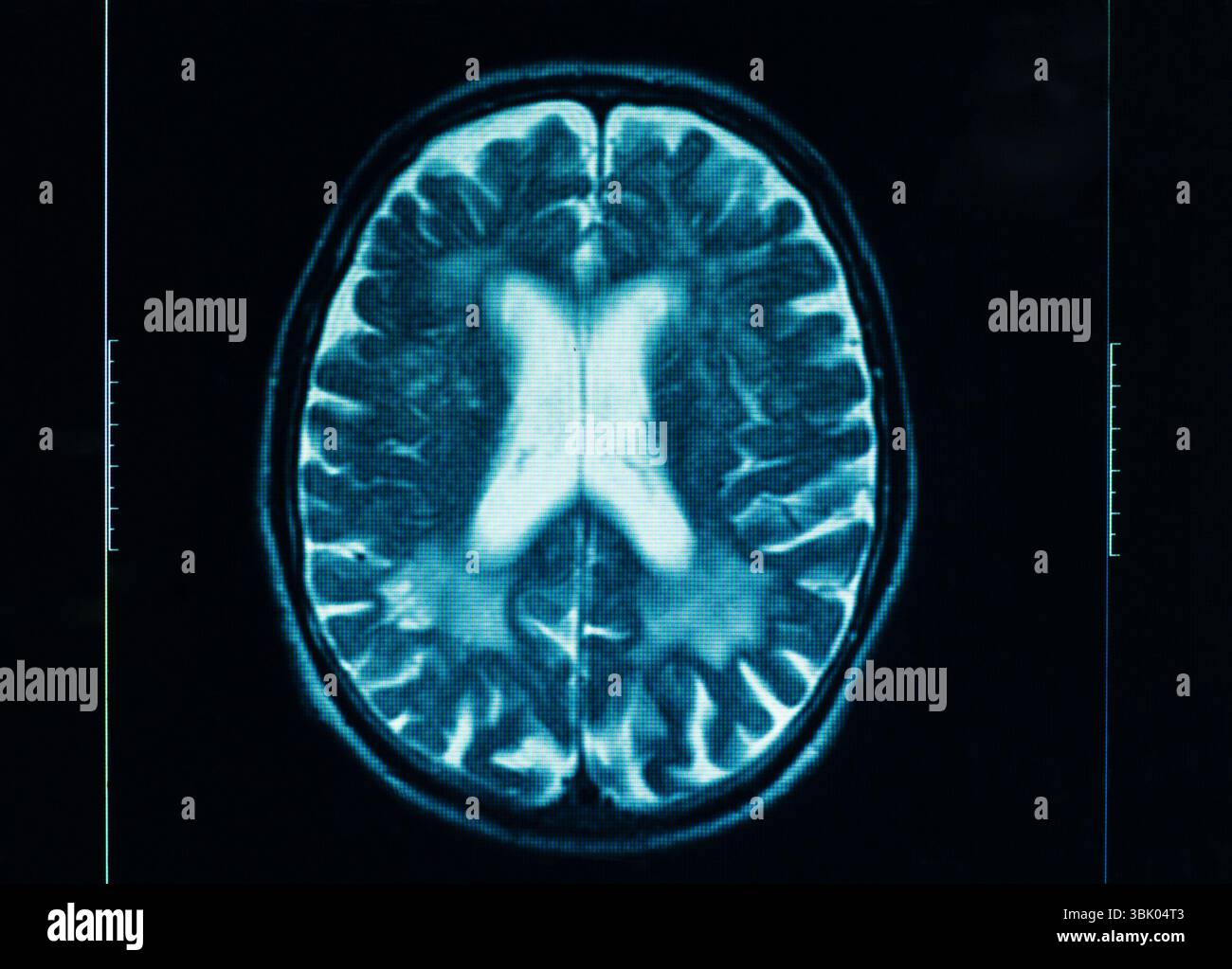 sharp ct scan of the human brain Stock Photo - Alamy