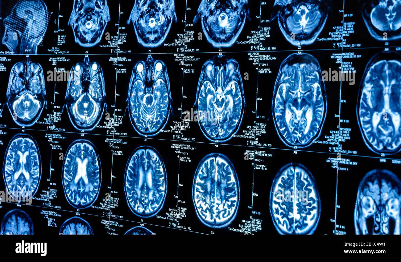 A group of CAT scans of the human brain closeup Stock Photo - Alamy