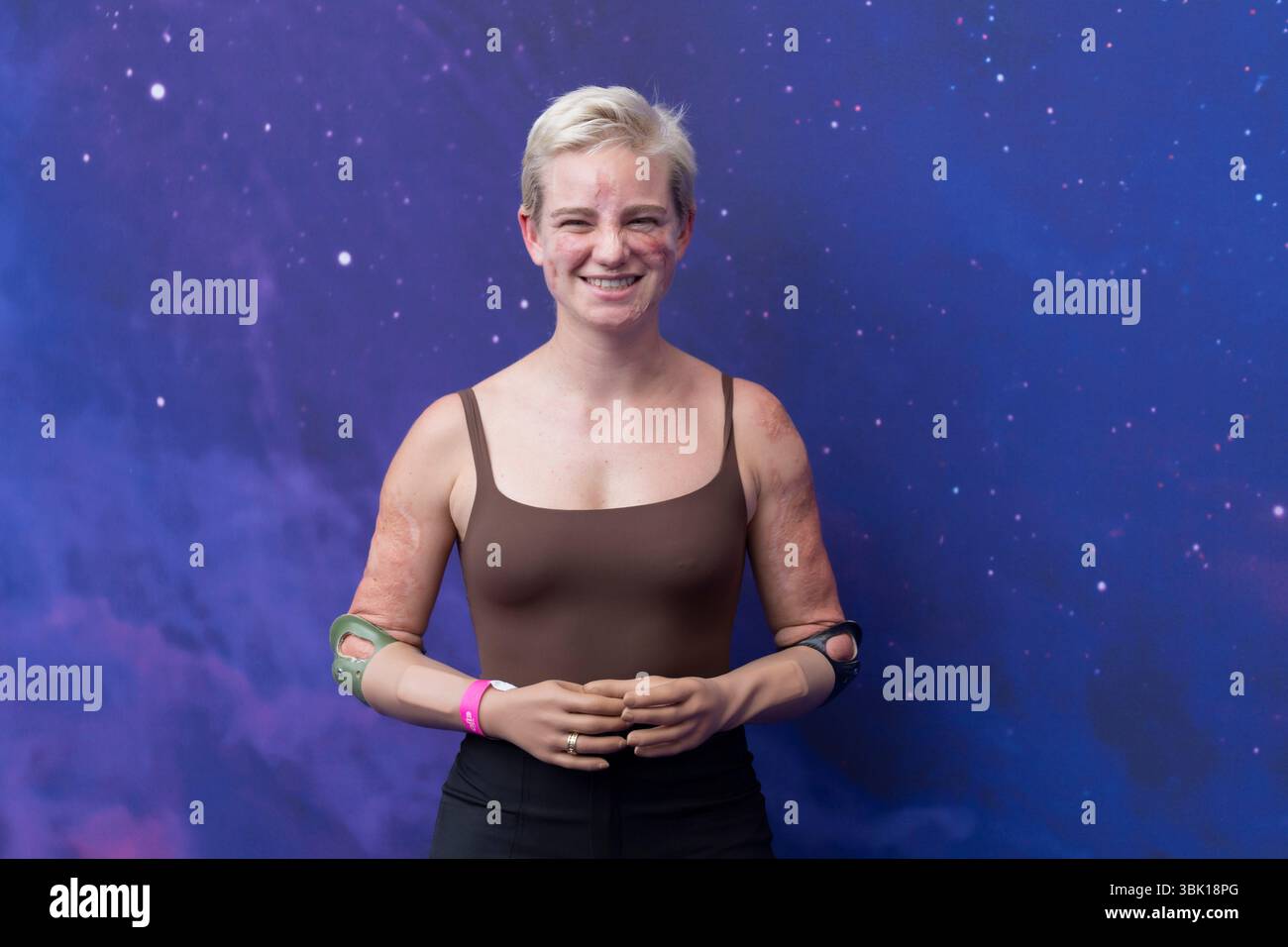 Rome, Italy, June 16, 2025 - Bebe Vio attends at red carpet for the ...