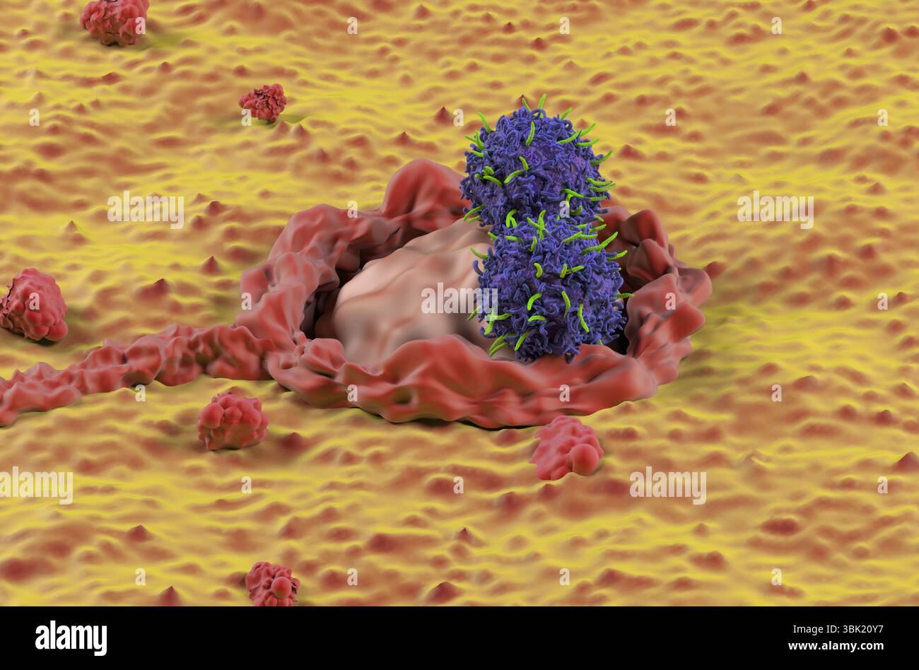 CAR T cell therapy in Colon, Colorectal cancer (CRC) - closeup view 3d ...
