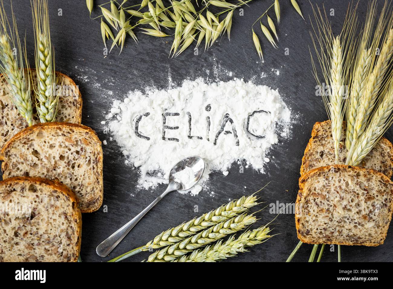 Celiac disease, an autoimmune genetic disorder, gluten intolerance ...