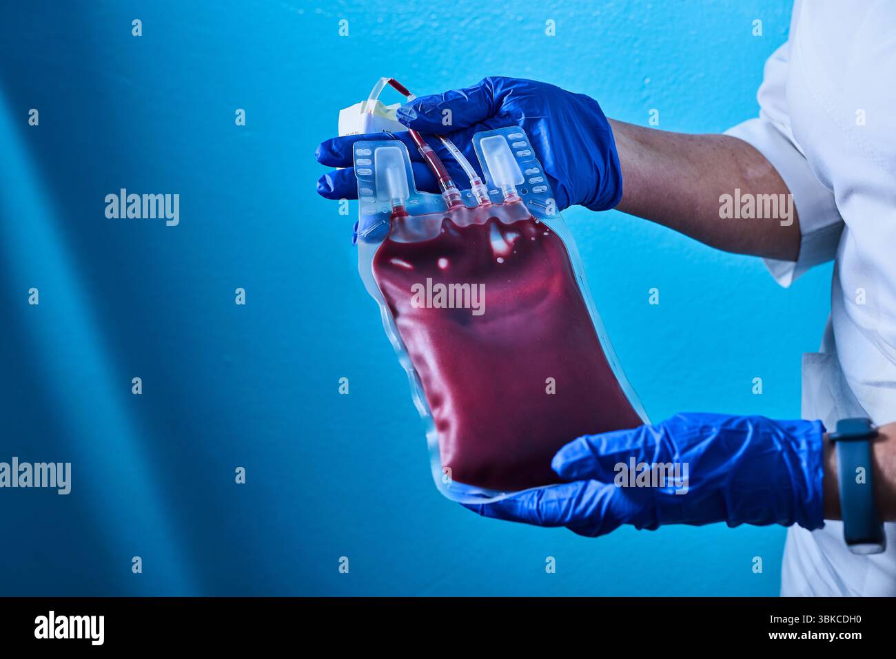Scientist wear blue gloves hand holding red blood bag from donor at ...