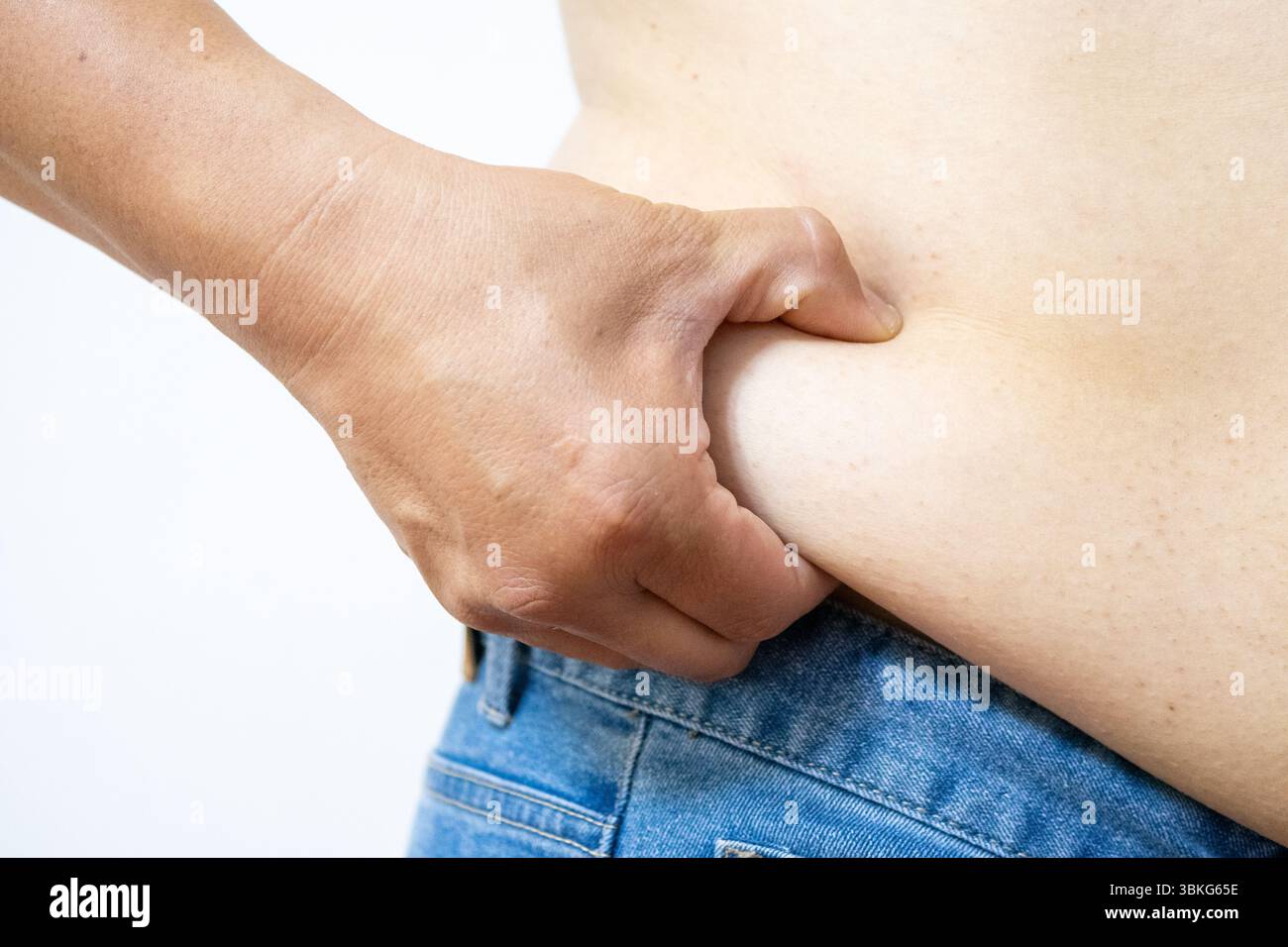 Obesity man body, fat male belly,A hand pinches the excessive fat on a ...