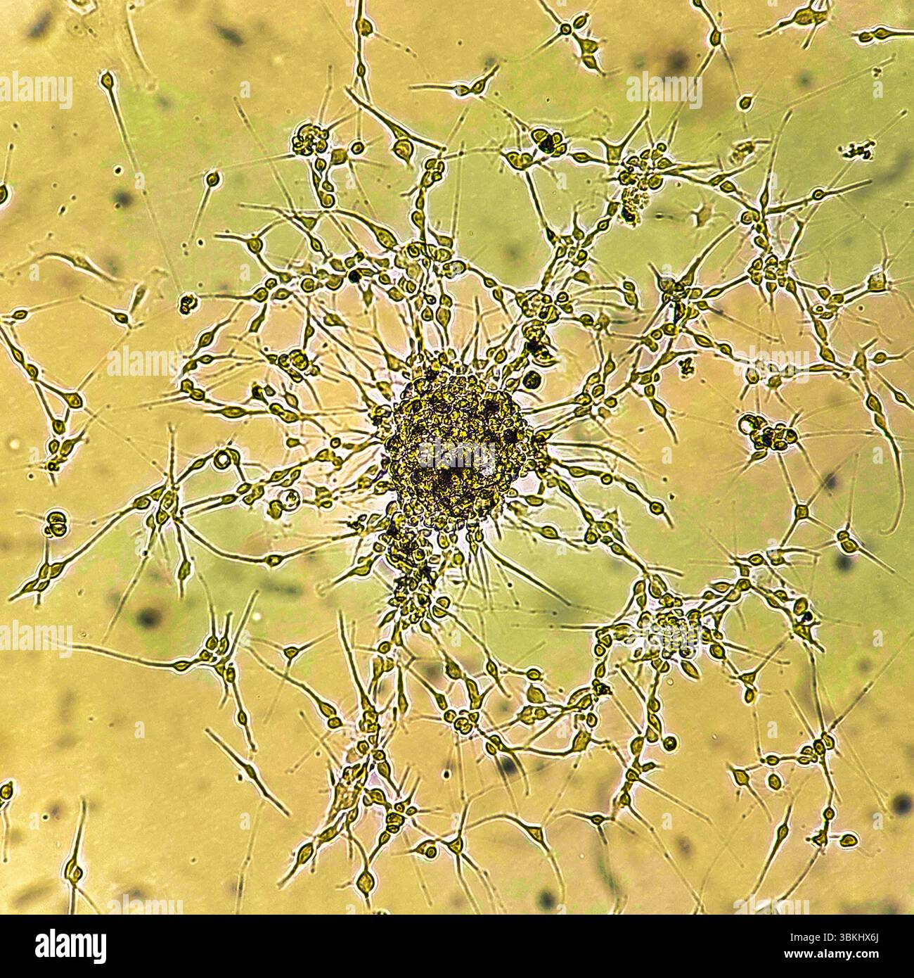Spheroids of glioblastoma cell culture. Spheroidal structures of human ...