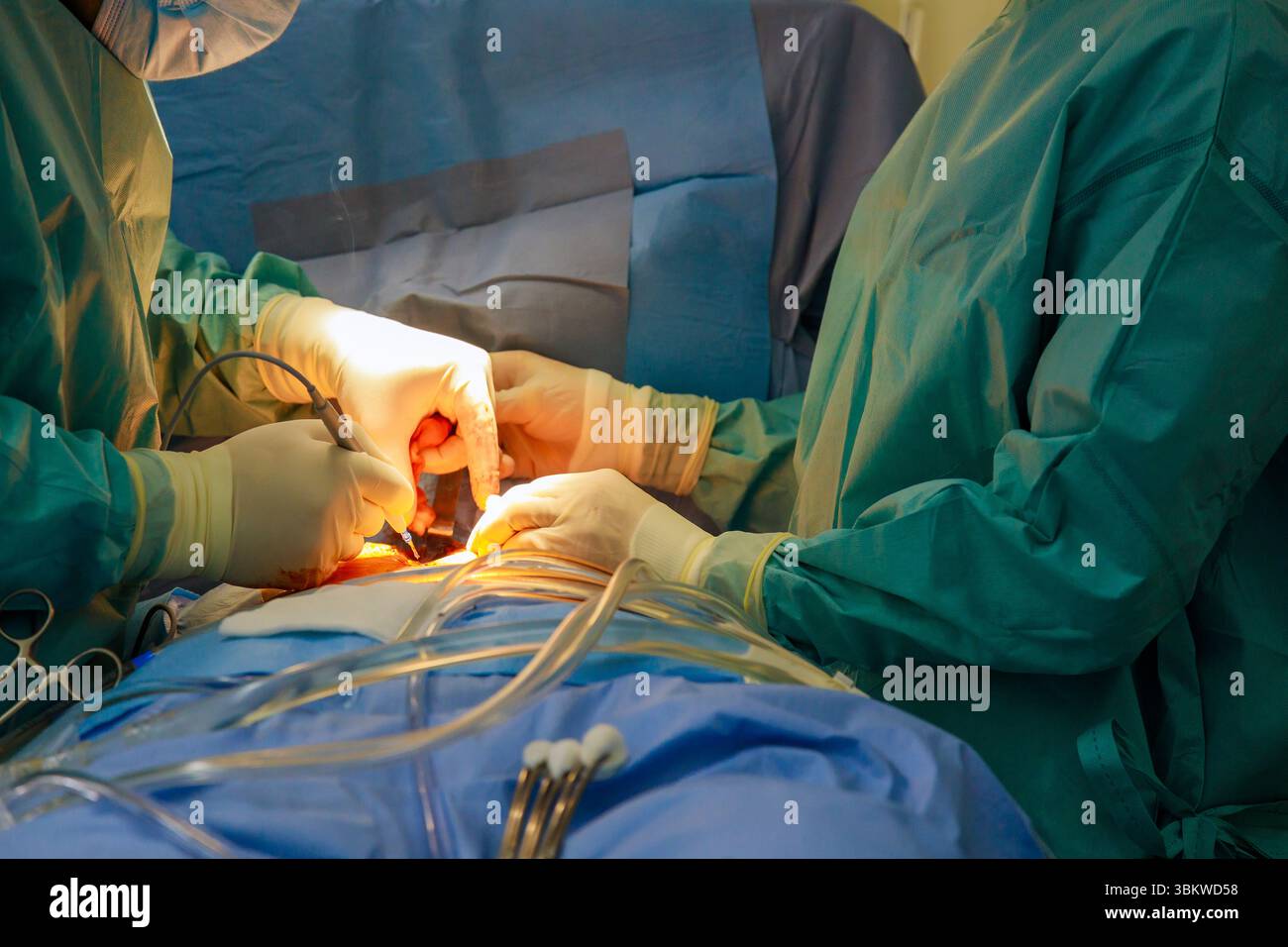 Two surgeons, one man and one woman, focus intently on surgery in ...