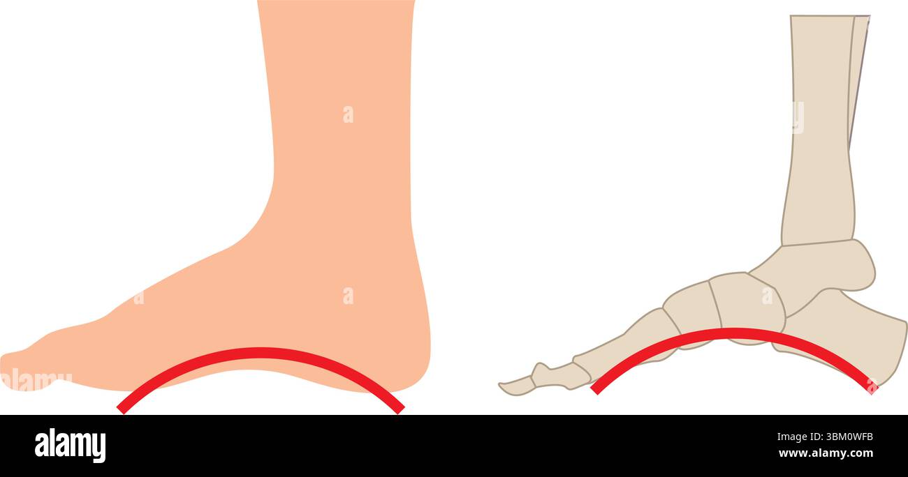 Feet pain shoe Cut Out Stock Images & Pictures - Alamy