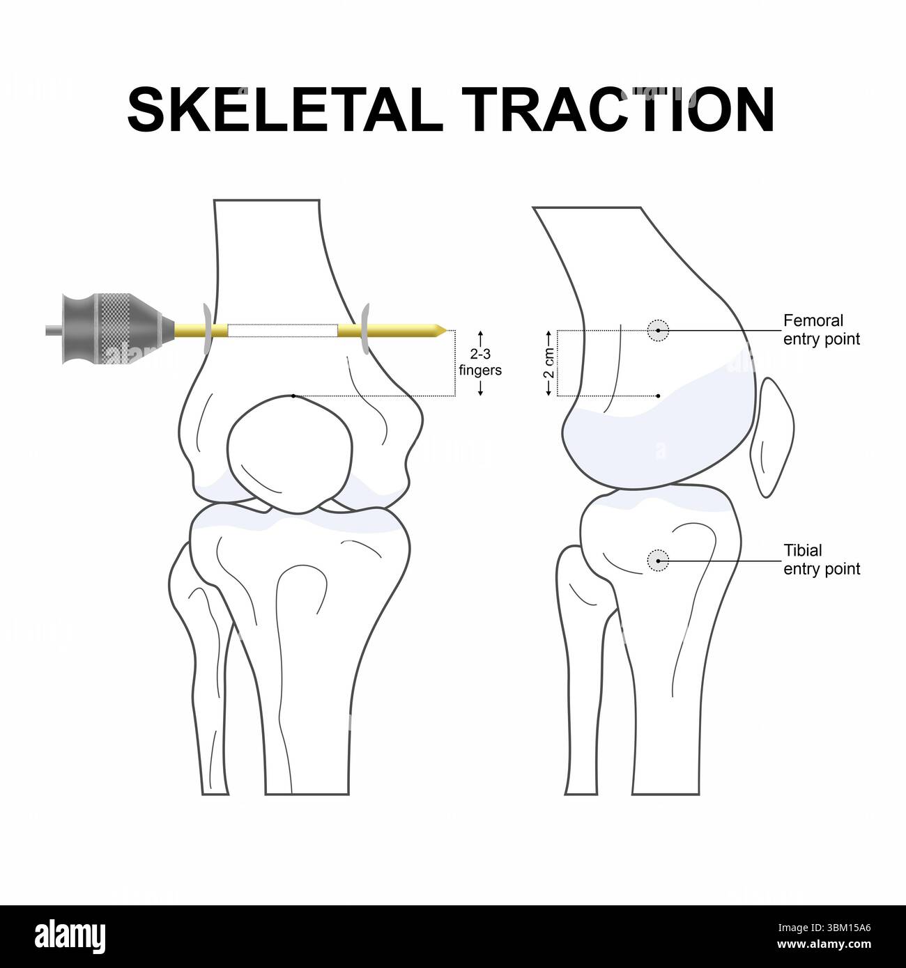 Skeletal chart Cut Out Stock Images & Pictures - Alamy