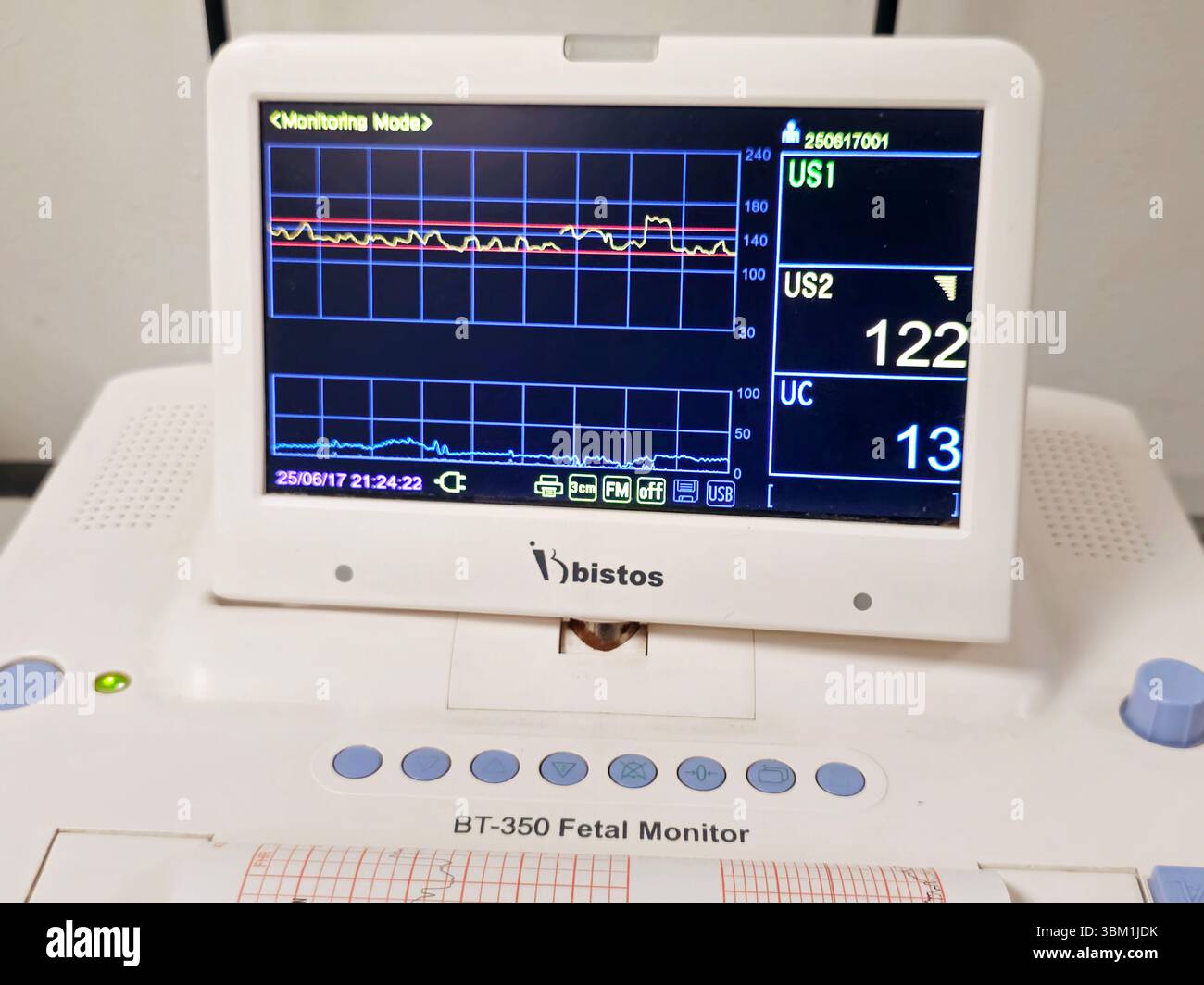 Cairo, Egypt, June 17 2025: Cardiotocography device placed on mother's ...