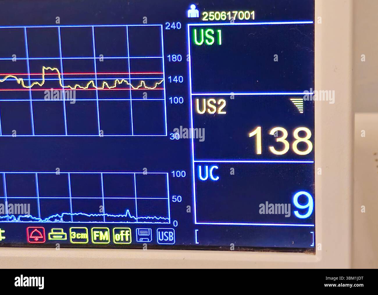 Fetal heartbeat ultrasound hi-res stock photography and images - Alamy