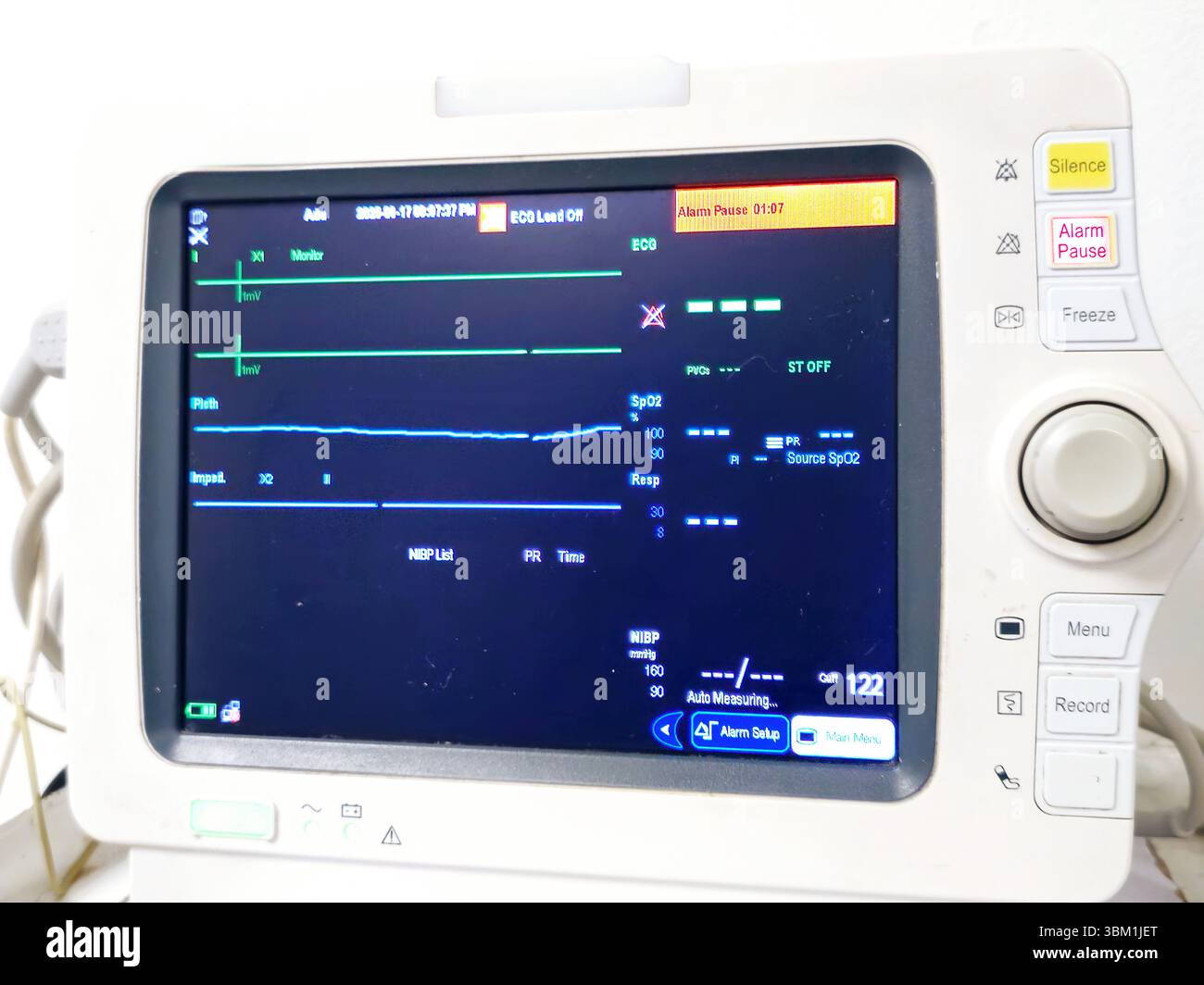Vital signs data medical monitor for measurement of important vital ...