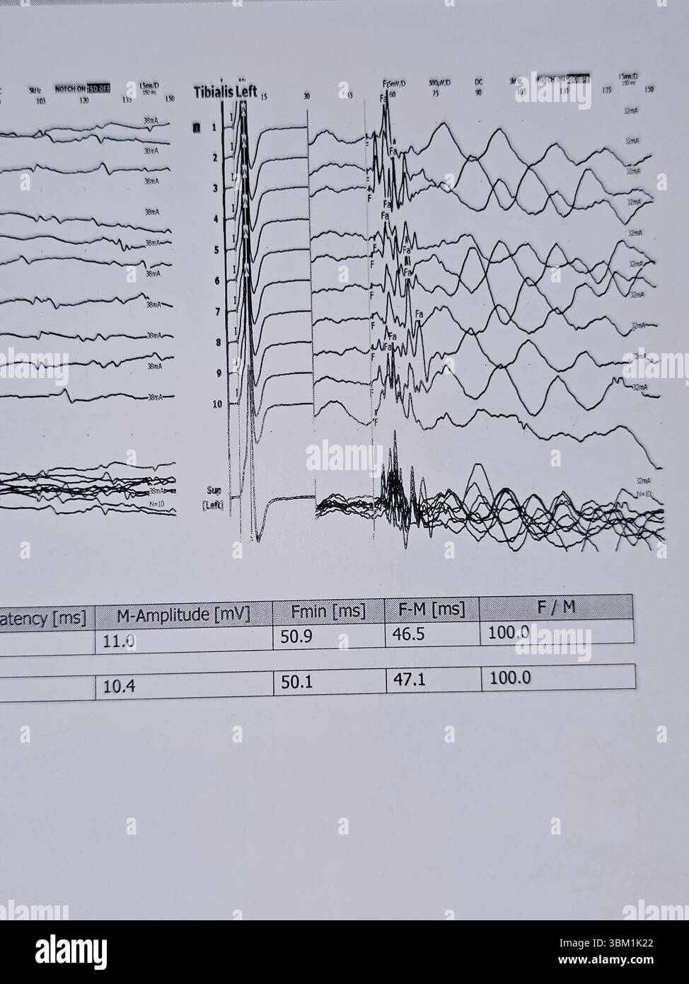Impulse conduction hi-res stock photography and images - Alamy