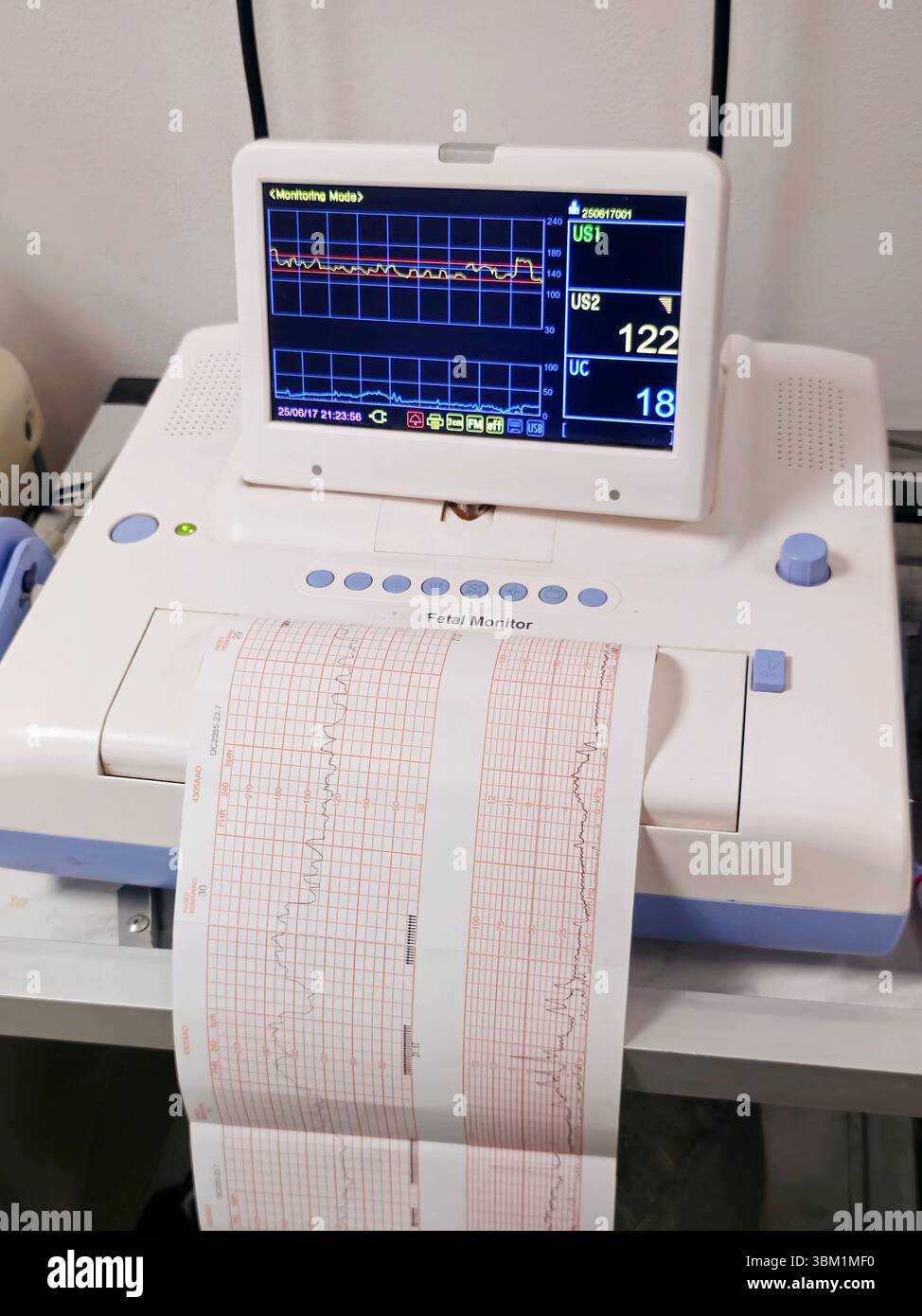 Cardiotocography device placed on mother's abdomen recording the fetal ...